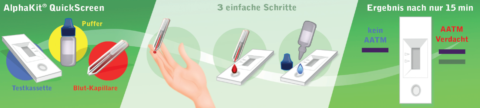 „Ich bin doch nur Träger“ – MZ und Alpha-1-Antitrypsin-Mangel